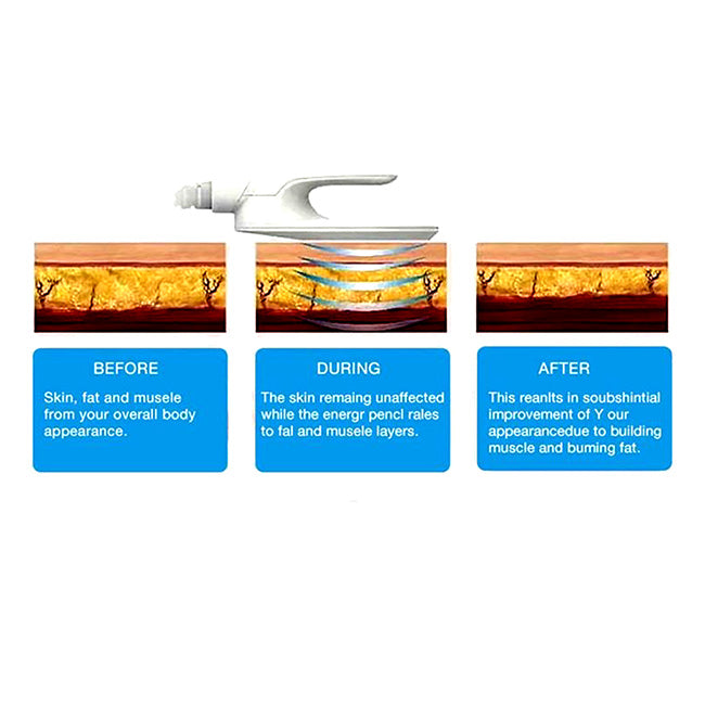 EMS Sculpting System - ComplexCity Aesthetics